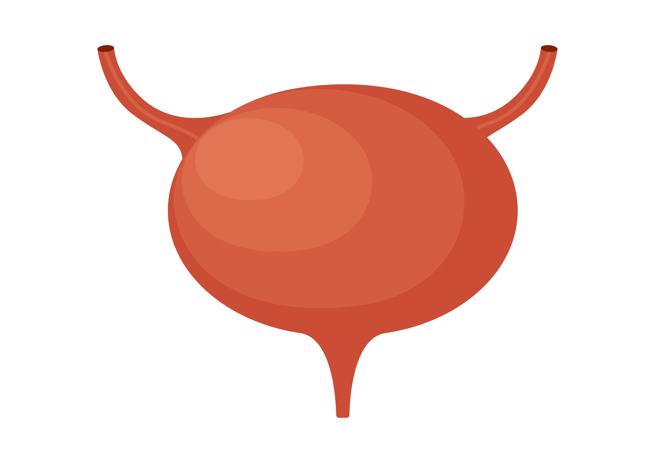 RTU bexiga - urologia, Urologista Goiânia, Dr. Breiner Ferro, Urologia ...